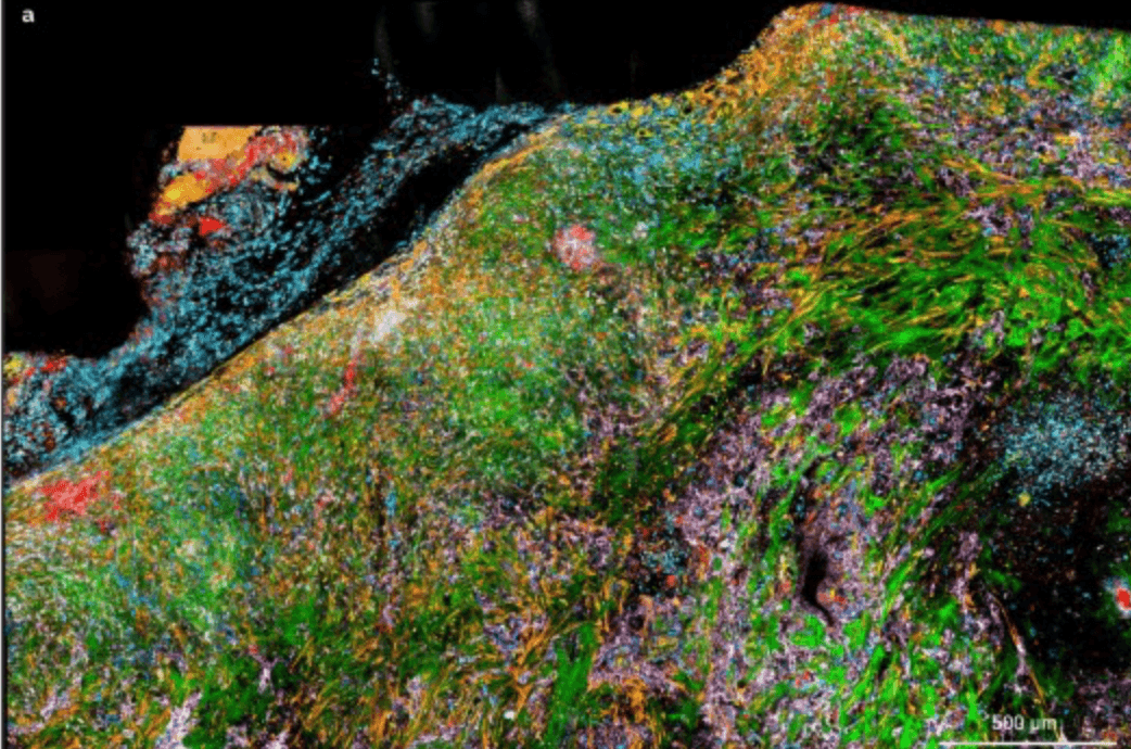 Leica Microsystems Announces New Imaging System for 3D High-multiplex ...